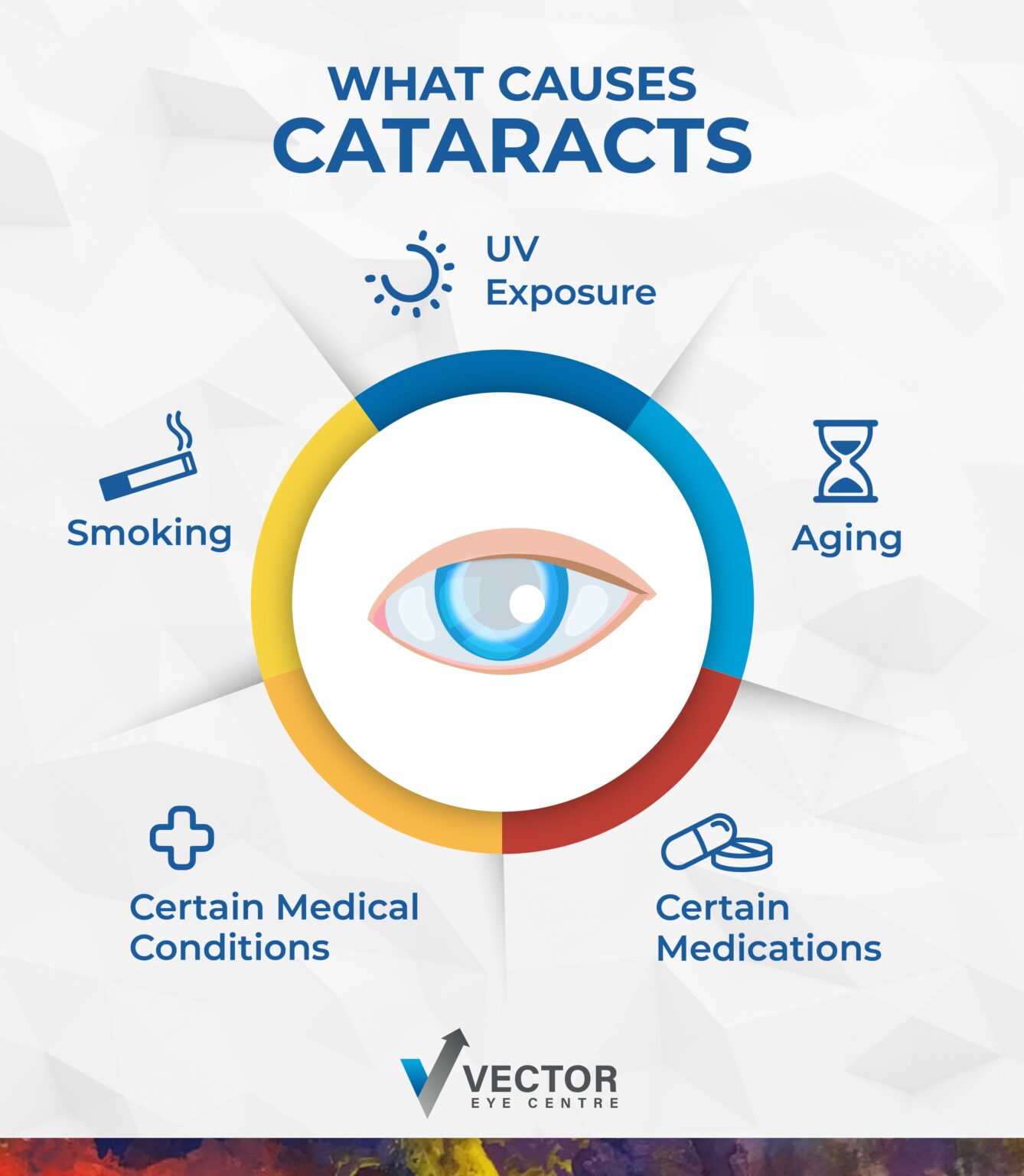 How Long Between Cataract Surgery on Each Eye?