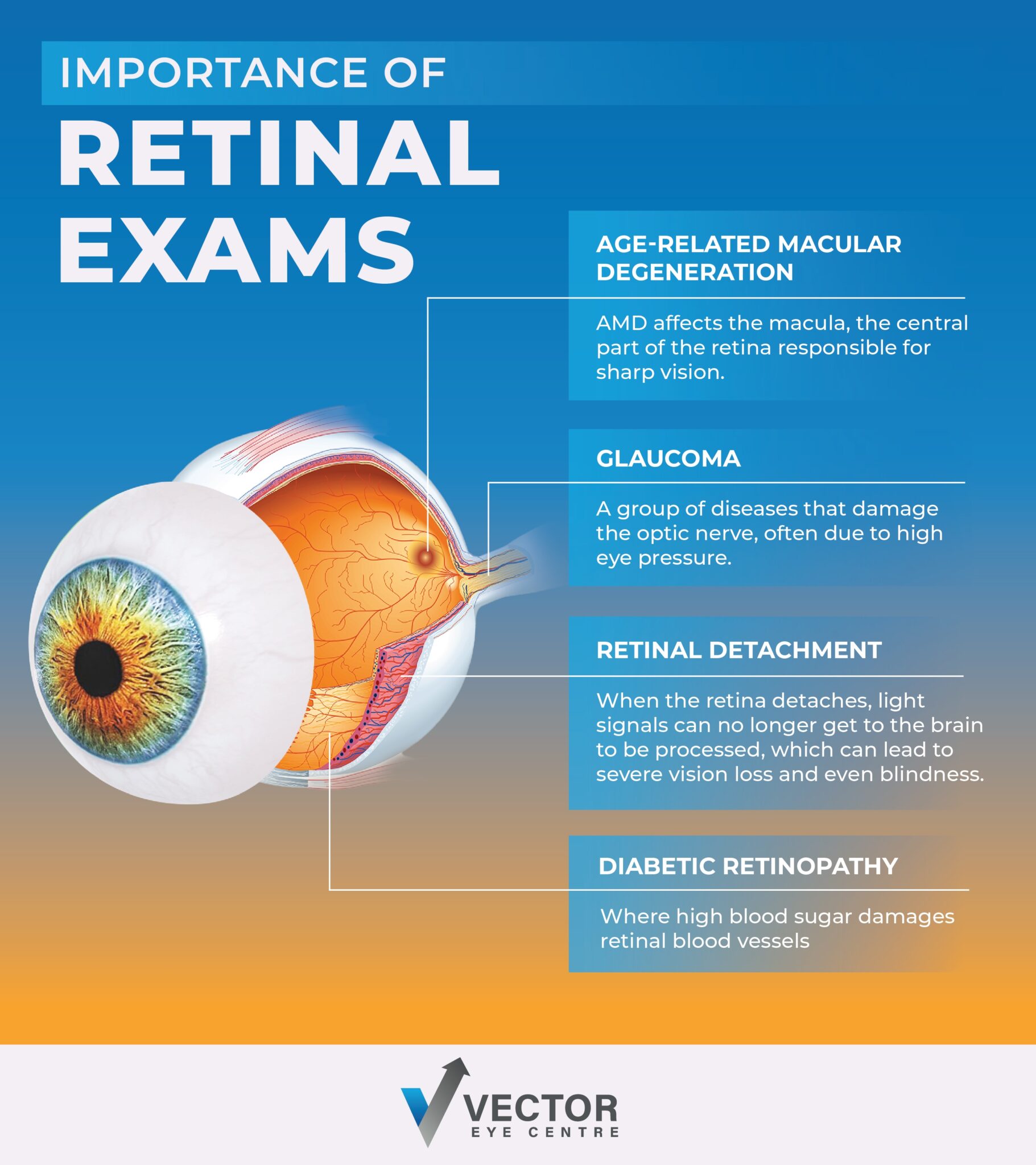 Why Regular Retinal Exams Are Important | Calgary