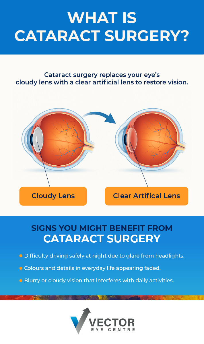 LASIK vs. Cataract Surgery: Understanding the Differences
